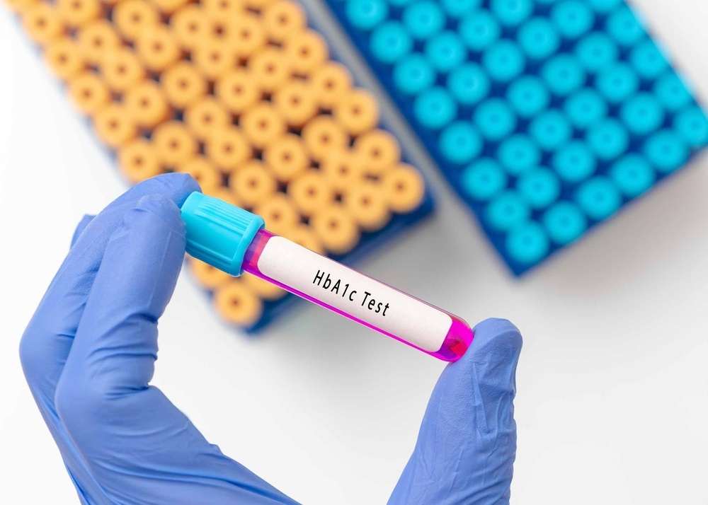 Understanding Glucose Tolerance Test: Normal Range Results and ...