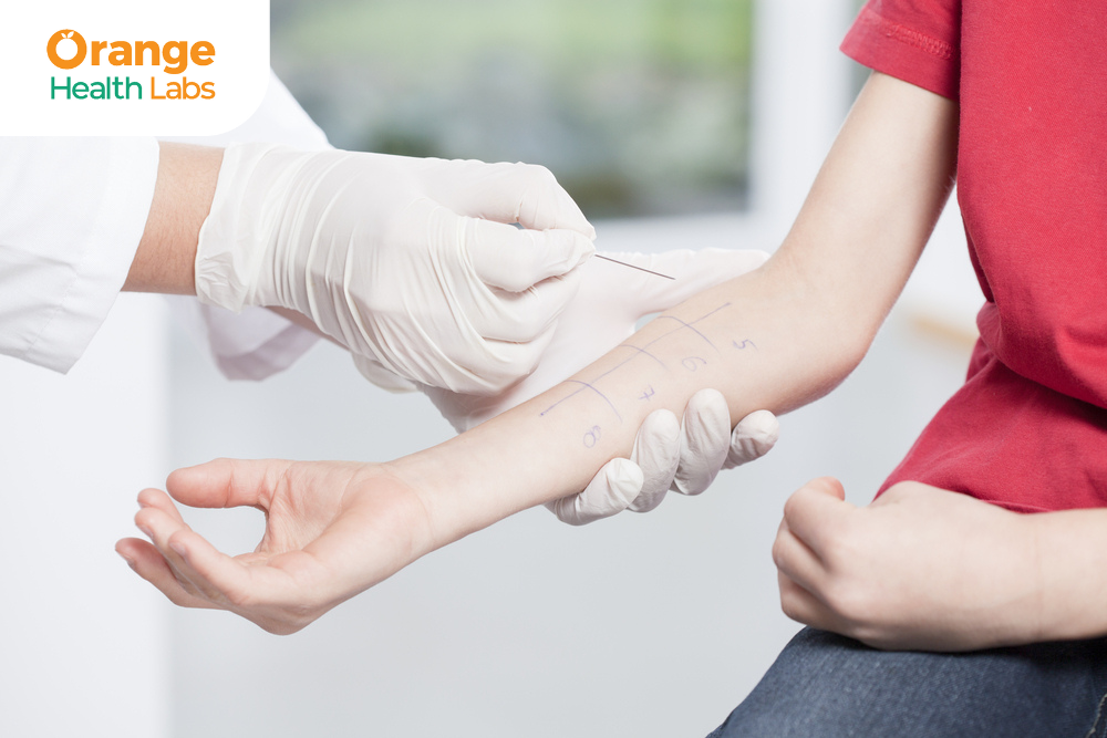 Is High IgE Level Dangerous? Causes, Risks & Testing Explained