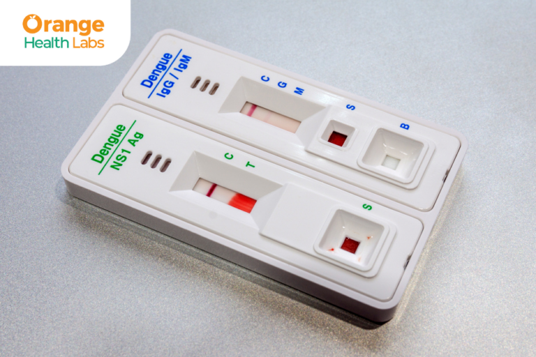 Early Dengue Detection: Why Timely Testing Matters